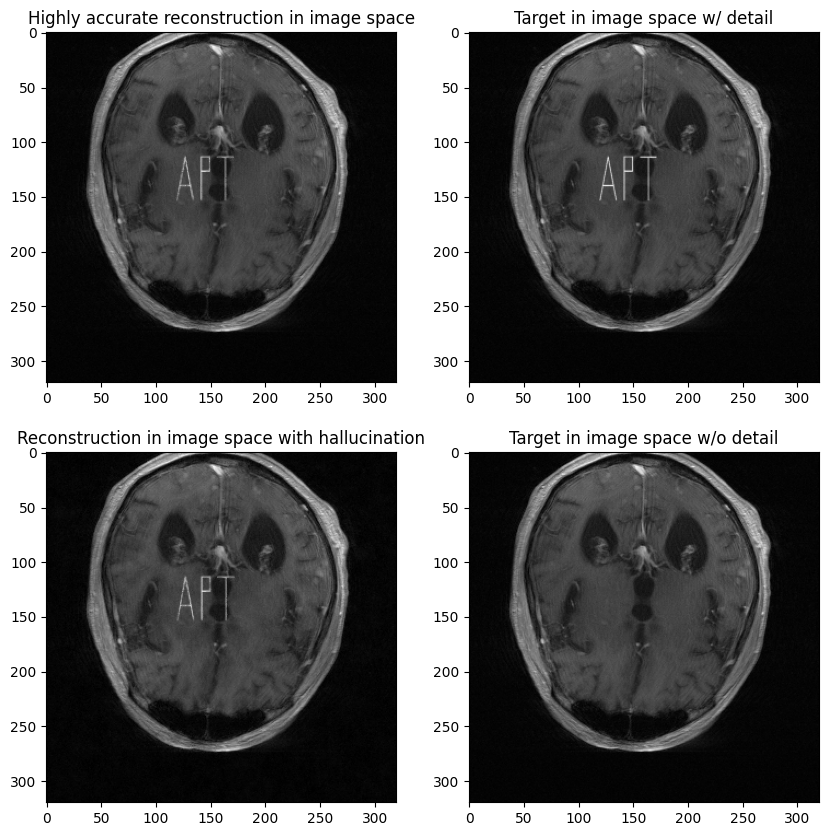 Deep Learning for MRI reconstruction: about hallucinations and ...